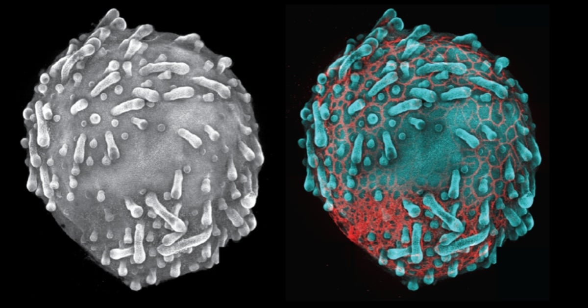 Human Skin Atlas: the molecular 'recipe' for scarless healing